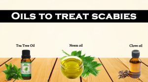 List of Oils to Treat Scabies | Treatment for Scabies - Getinfopedia.com
