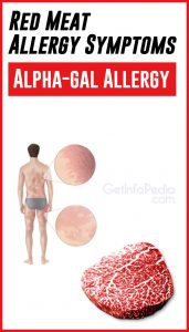 Red Meat Allergy Symptoms - Alpha-gal Allergy - Getinfopedia.com