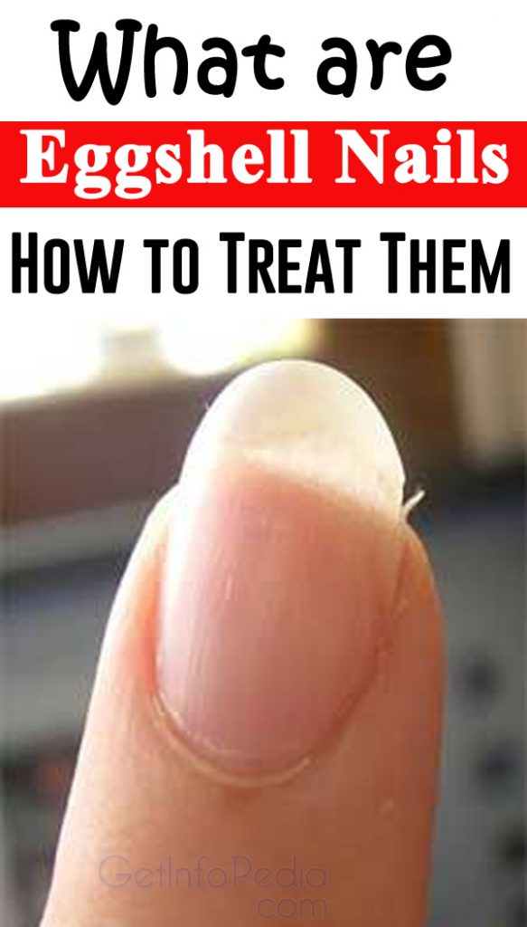 What are Eggshell Nails? - How to Treat Them? - Getinfopedia.com